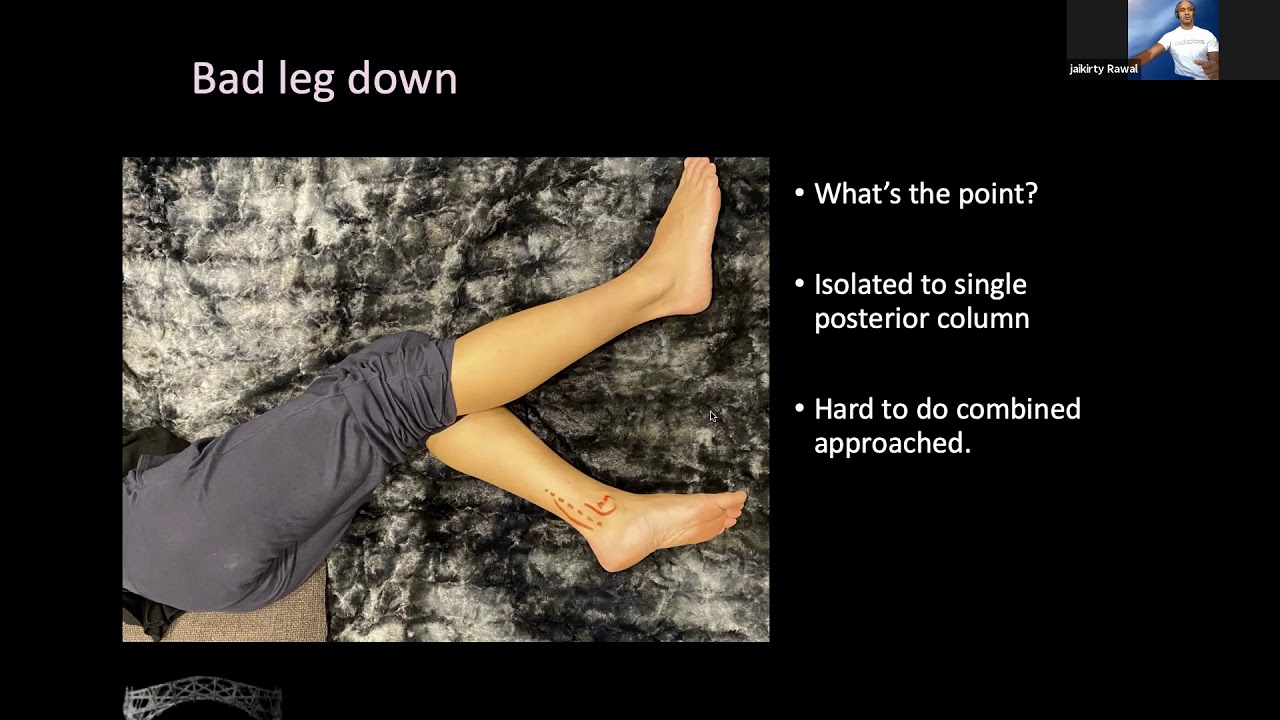 Ankle posteromedial approaches - Mr Jaikirty Rawal - YouTube