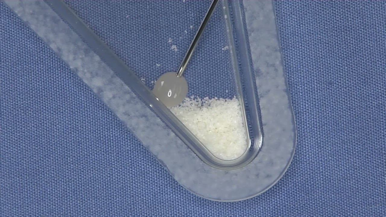 Single Flap Approach in combination with Enamel Matrix Derivative ...