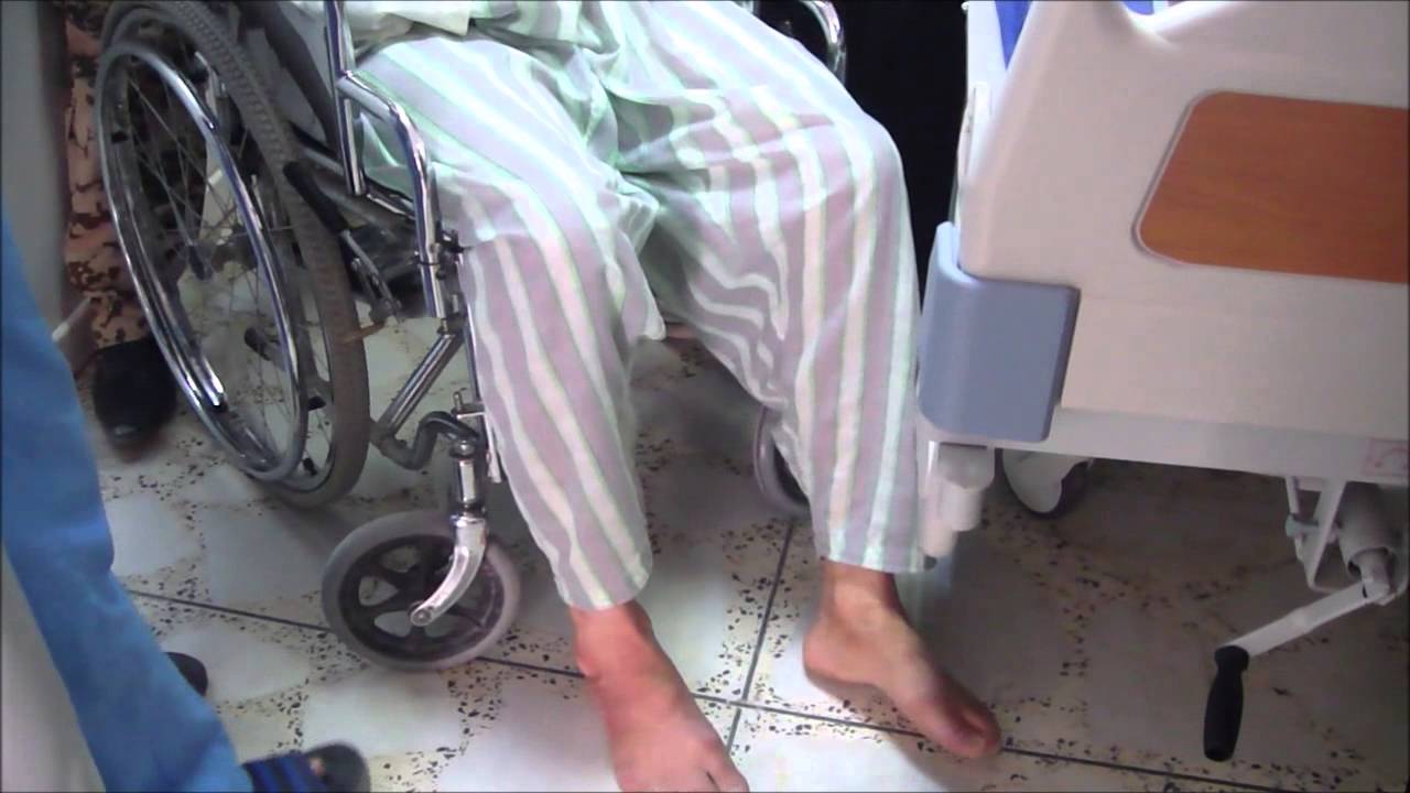 Left Leg Focal Motor Seizures - YouTube