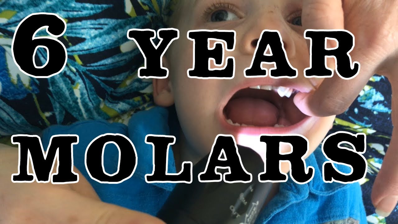 6 Year Molars - YouTube