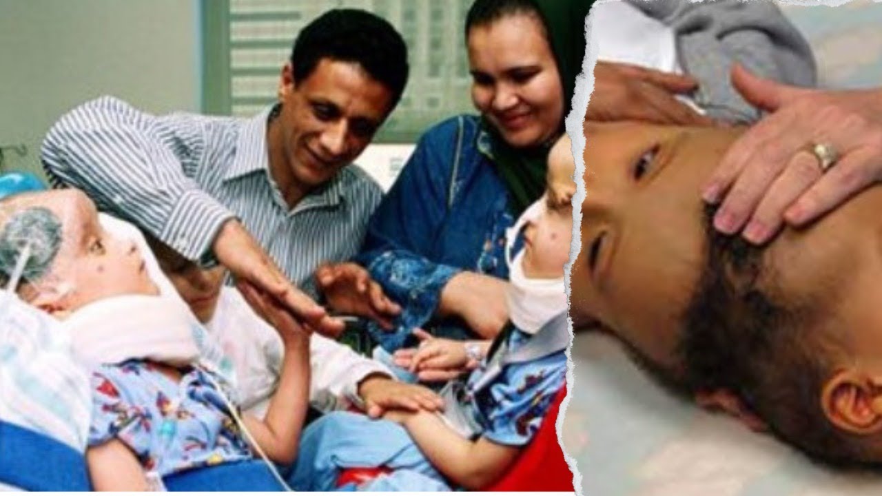 Separated After 34 Hours The Incredible Story of Mohamed and Ahmed ...