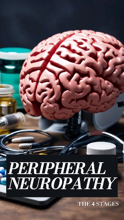 The 4 Stages of Peripheral Neuropathy (Complete Video on Youtube) 🧠 #neuropathy #neuroscience ...