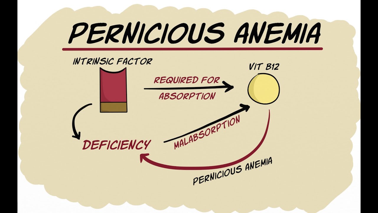 Pernicious Anaemia Mechanism