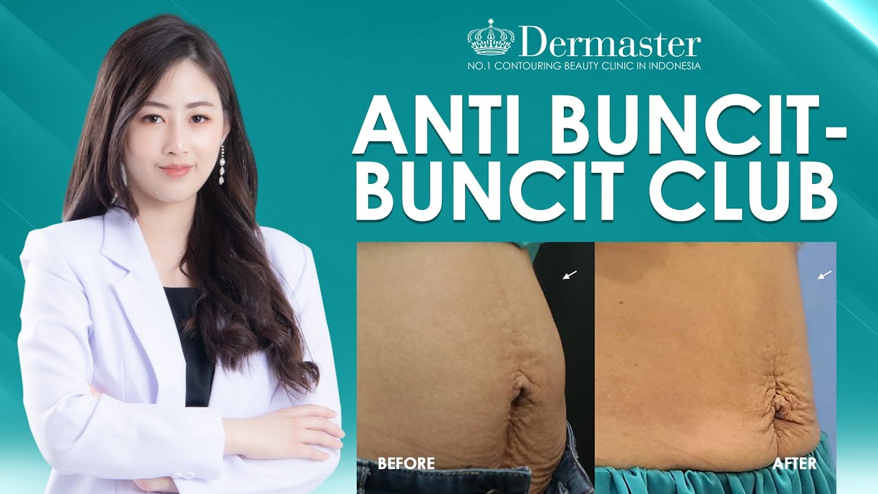 Anti Buncit-Buncit Club!! | Meet The #BeautyExpert : Episode 15 - YouTube