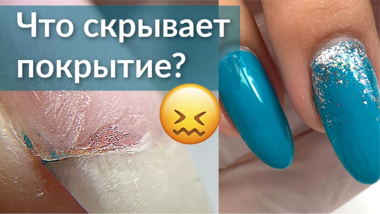Почему трескается гель-лак на ногтях - что делать и как спасти, если ...