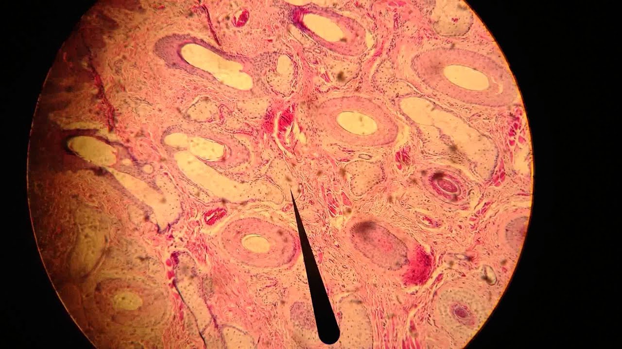 Slide 8 apocrine and sebaceous gland in lip - YouTube