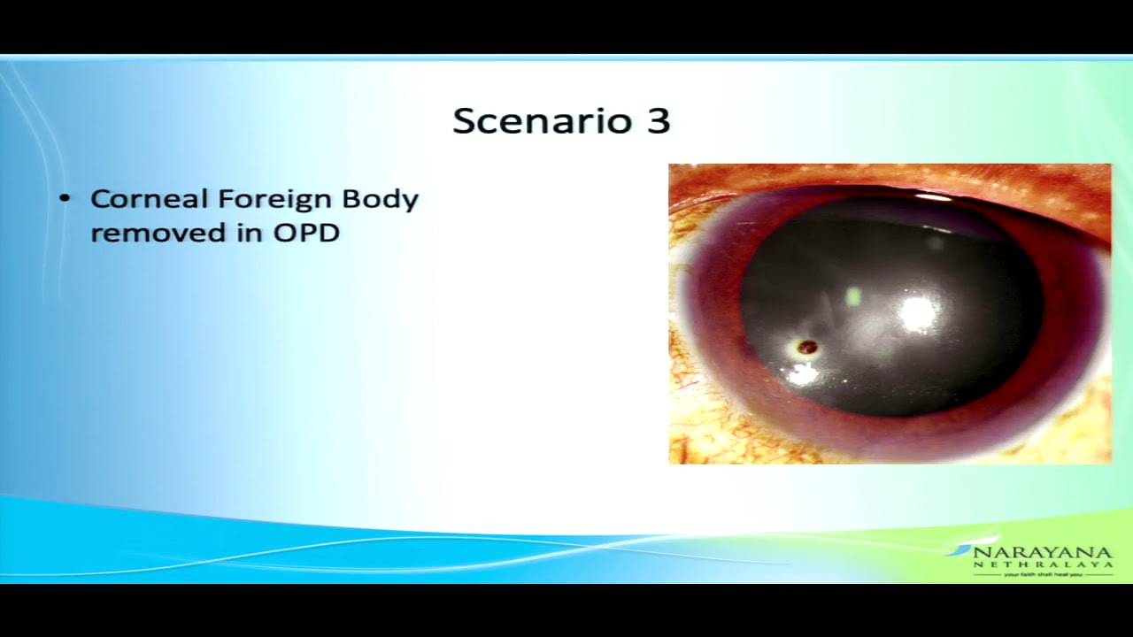 AIOC2020 IC448 T4 Dr Gagan Dudeja - YouTube