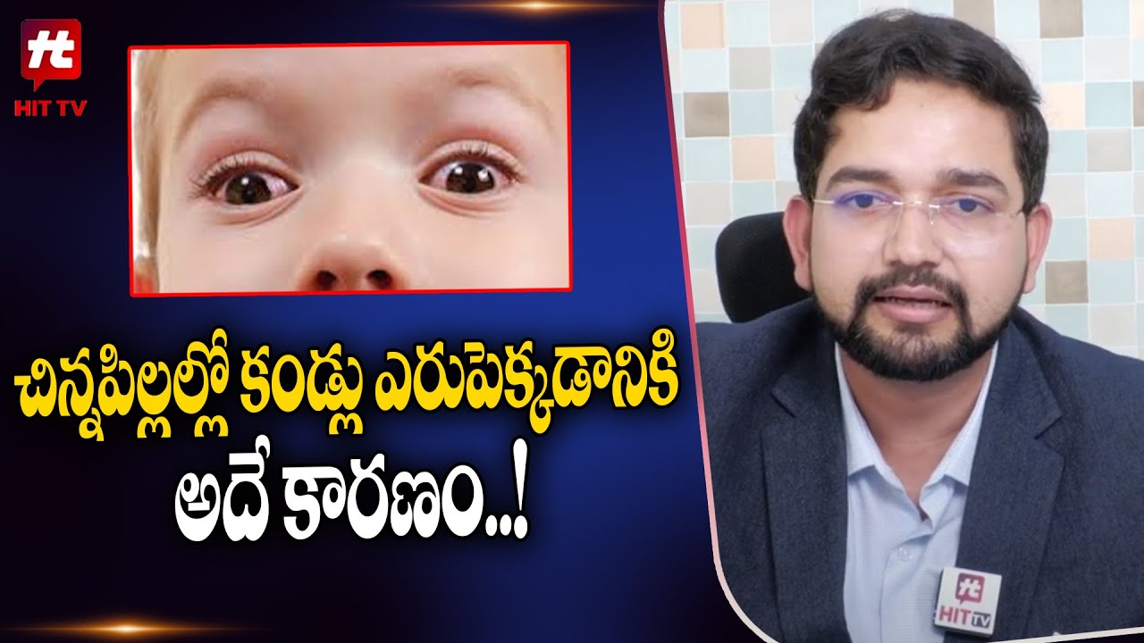 చిన్నపిల్లల్లో కండ్లు ఎరుపెక్కడానికి అదే కారణం..! | Dr. AMITH KUMAR ...