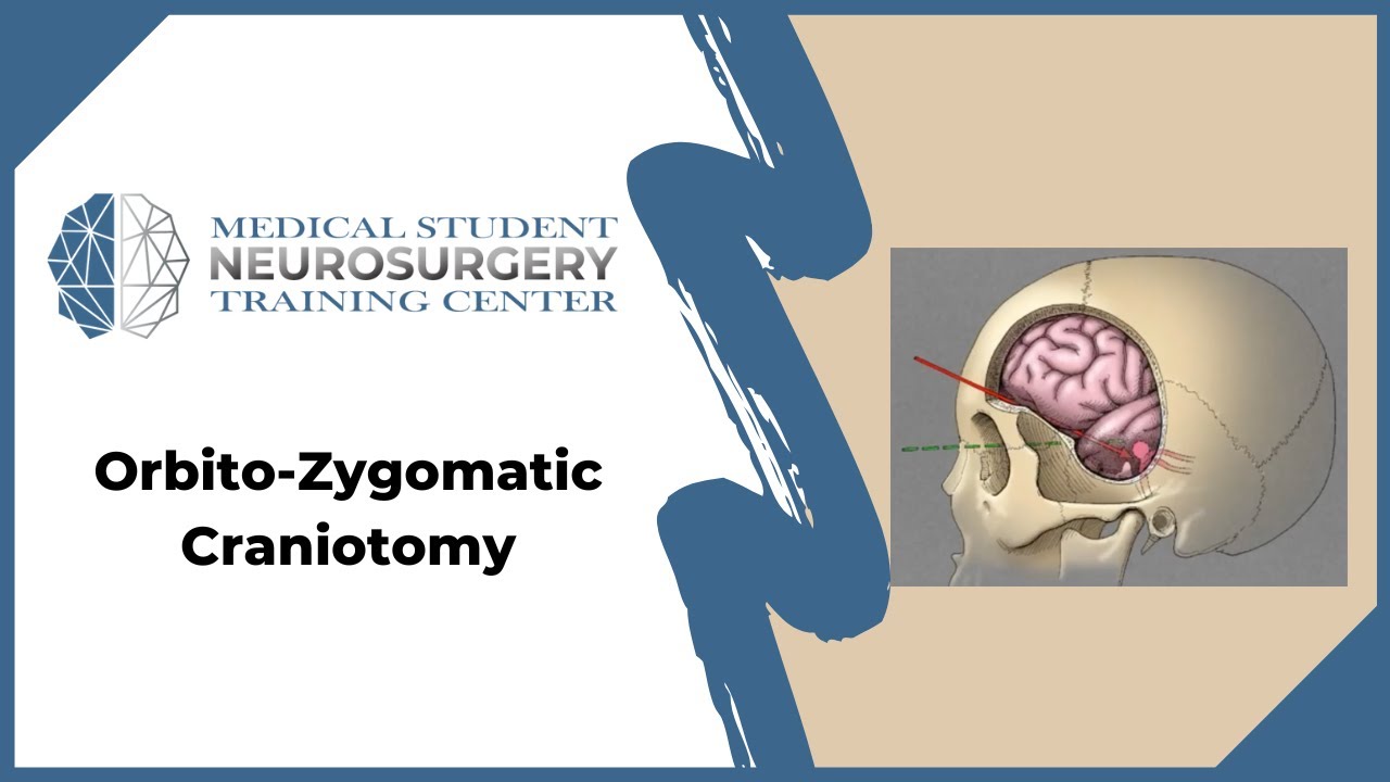 Orbito-Zygomatic Craniotomy - YouTube