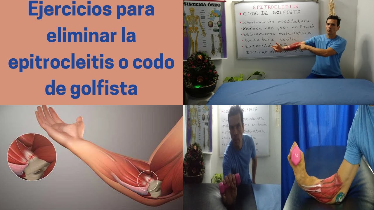 Epitrocleitis O Codo De Golfista - YouTube