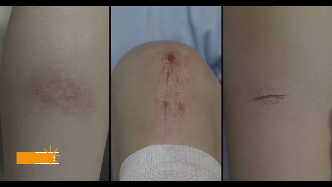 Scar Z TVC (unofficial) - YouTube