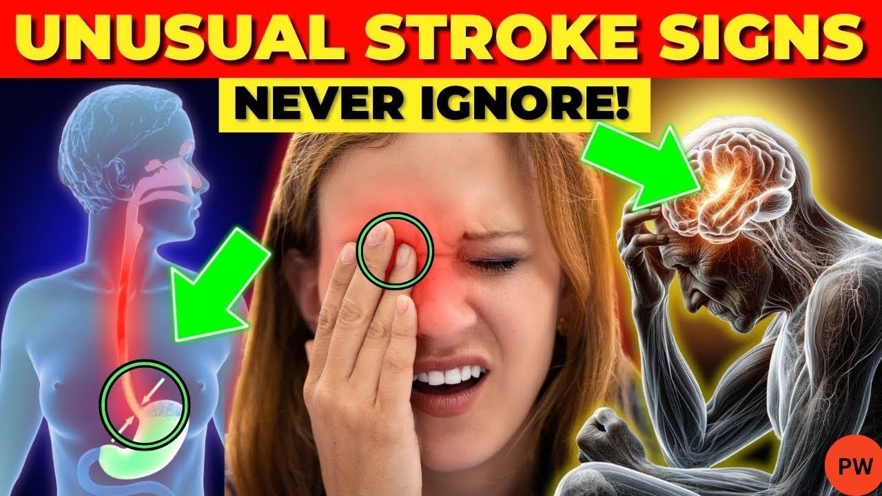 8 Uncommon SIGNS of Strokes You Should Know About - Are You at Risk ...