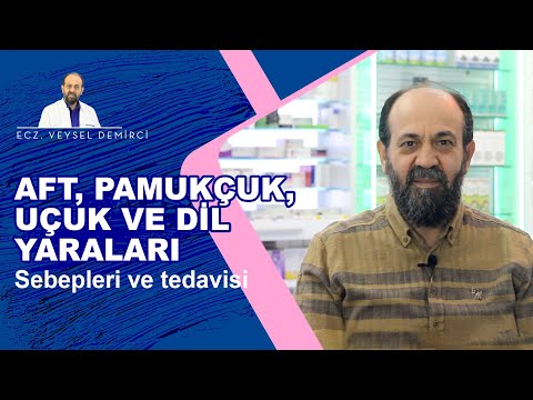 AFT, PAMUKÇUK, UÇUK VE DİL YARALARININ SEBEPLERİ NELERDİR? NASIL GİDERİLİR?