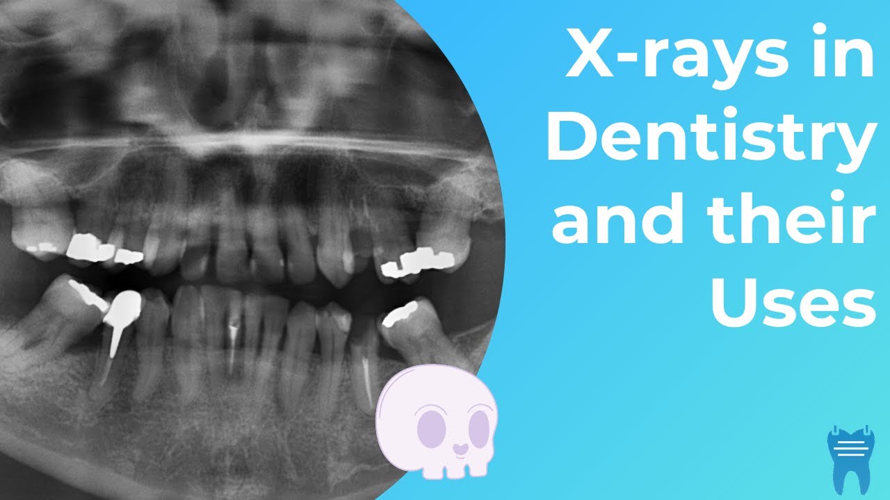 Types Of Dental X rays You NEED To Know Dental Radiographs And Why We
