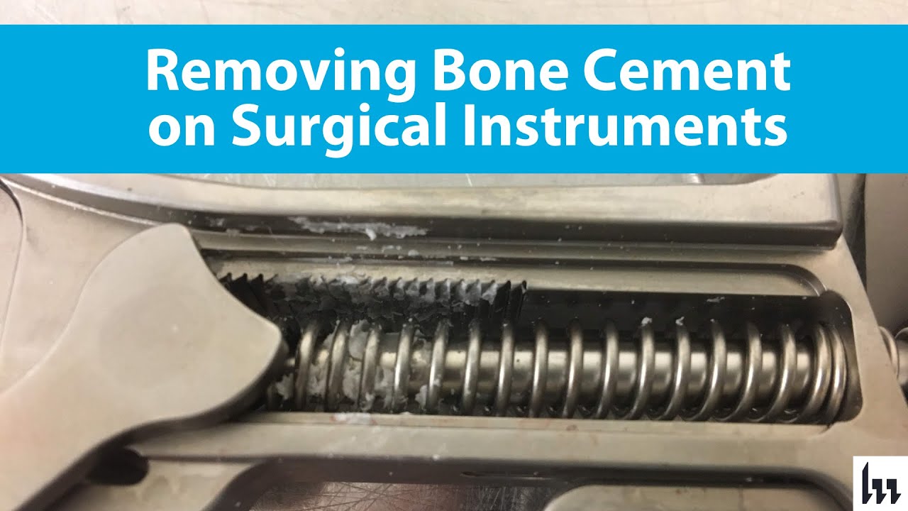 Removing Bone Cement on Surgical Instruments - YouTube