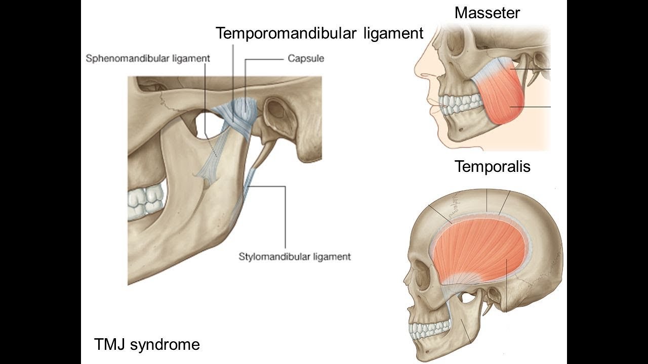 TMJ and jaw pain can be treated with Osteodouce. - YouTube