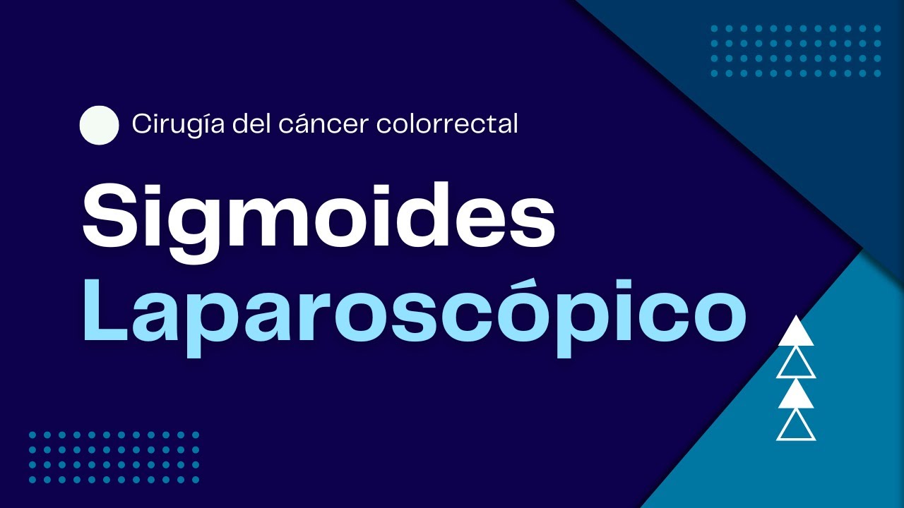 Explorando la Sigmoidectomía Laparoscópica para el Cáncer Colorrectal ...