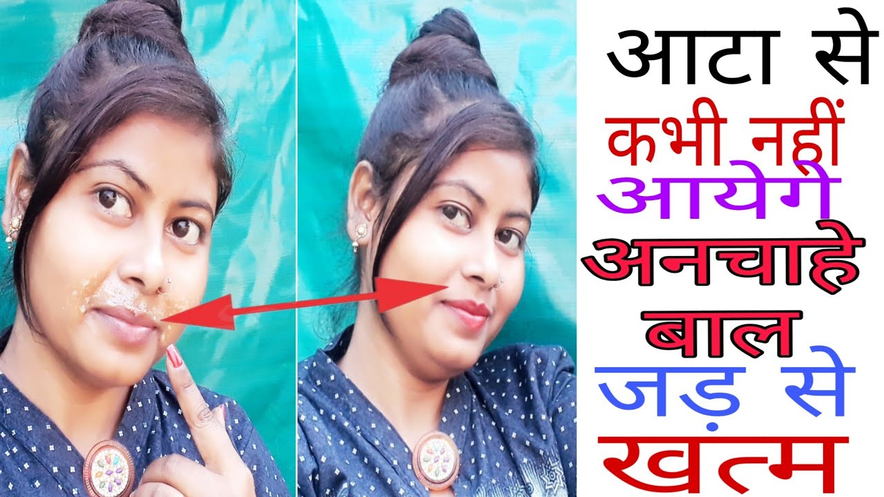 Unwanted Hair Facial Hair Remove Permanently unwanted-hair-facial-hair-remove-permanently