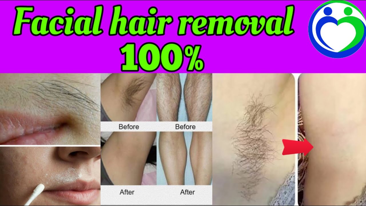 How To Remove Facial Hair Hair Removal How To Get Rid Of Body And