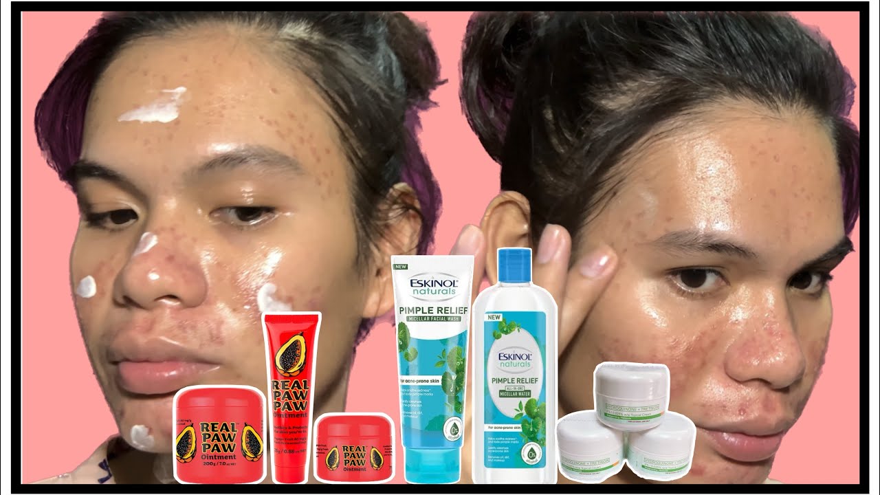 What to apply after TCA CROSS? | SKIN CARE AFTER TCA CROSS - YouTube