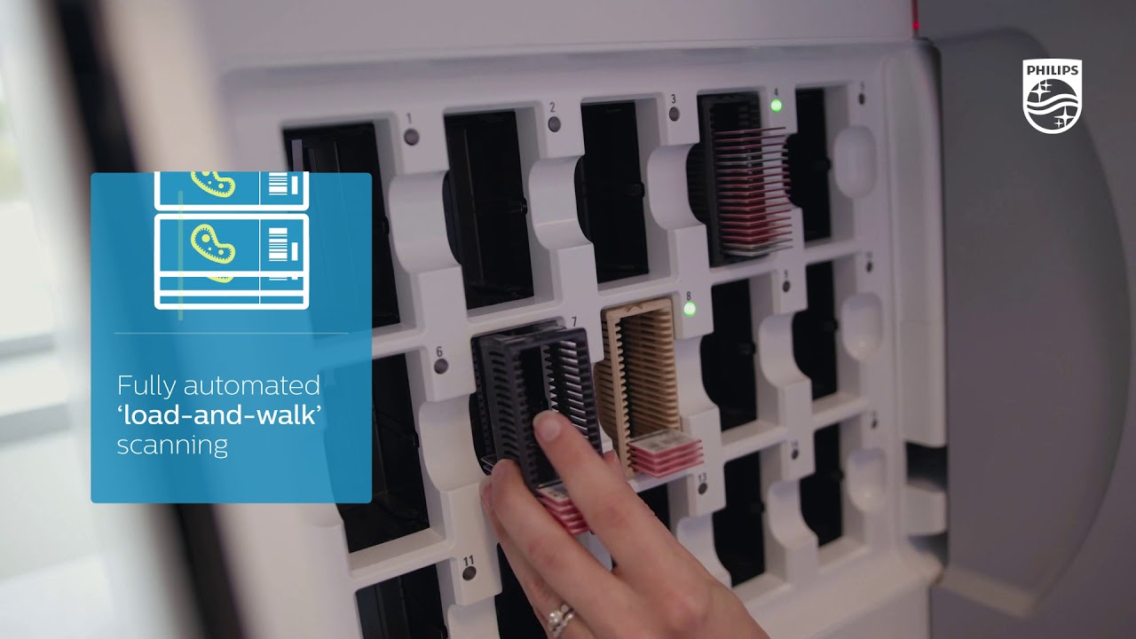 Philips IntelliSite Pathology Solution. - YouTube