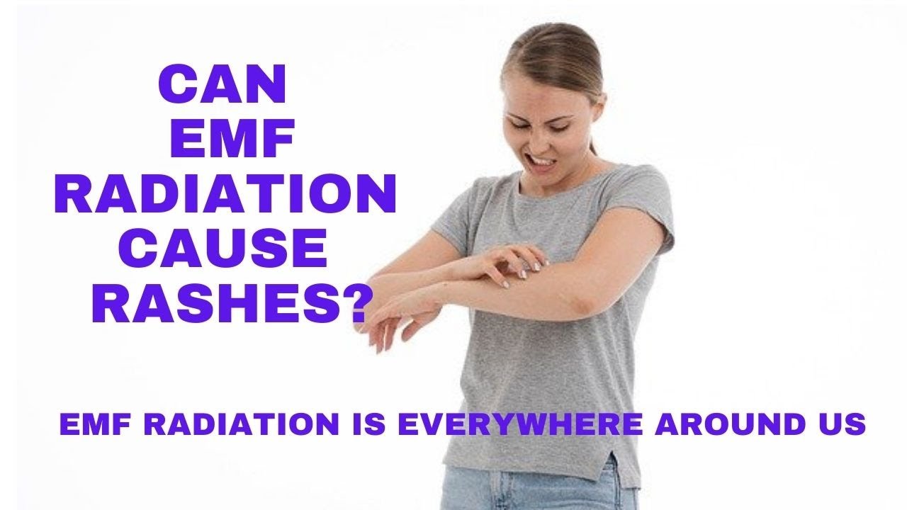 Can EMF Radiation Cause Rashes - EMF radiation is everywhere around us ...