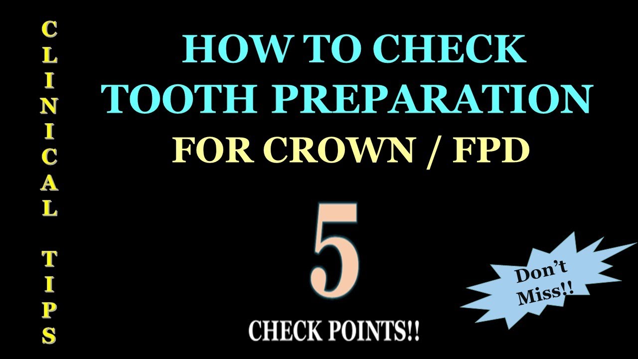 CHECK POINTS FOR TOOTH PREPARATION FOR CROWN & FPD / How to check ...