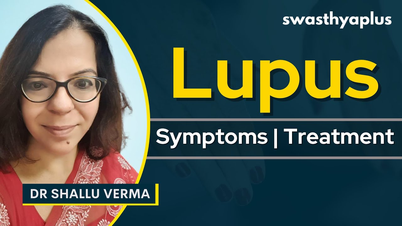 What is Lupus (SLE)? | Autoimmune Disease | Symptoms & Treatment | Dr ...