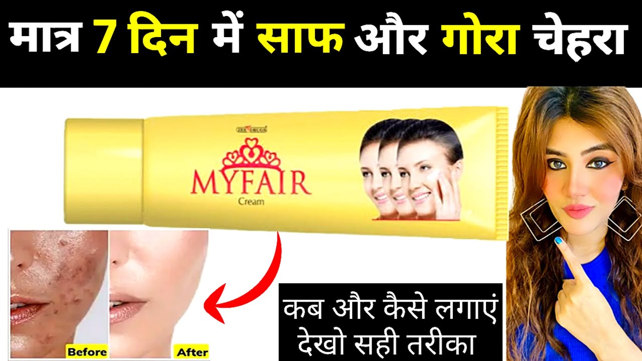 My Fair Cream Review 2024 | my fair cream kaise use kare | myfair cream ...