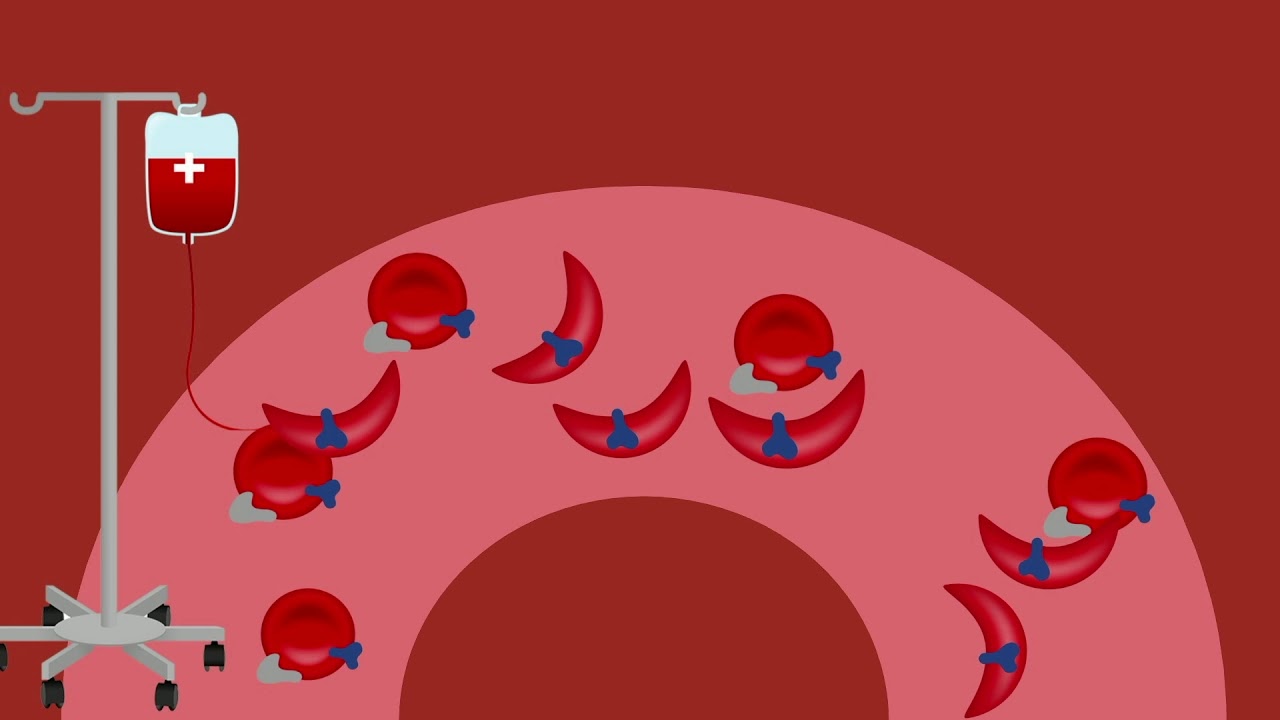 Episode 3: Transfusion reactions - YouTube