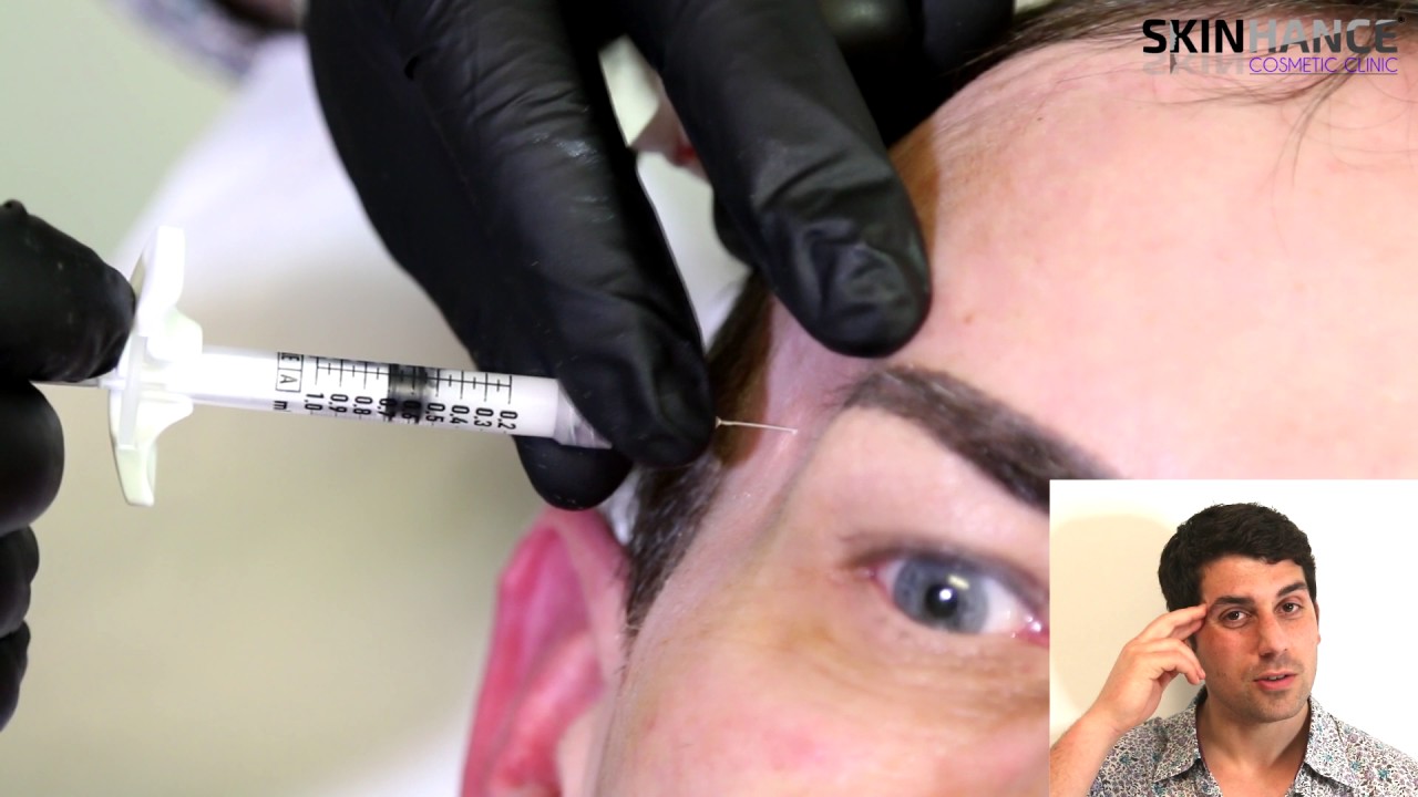 Temporal Filler - YouTube