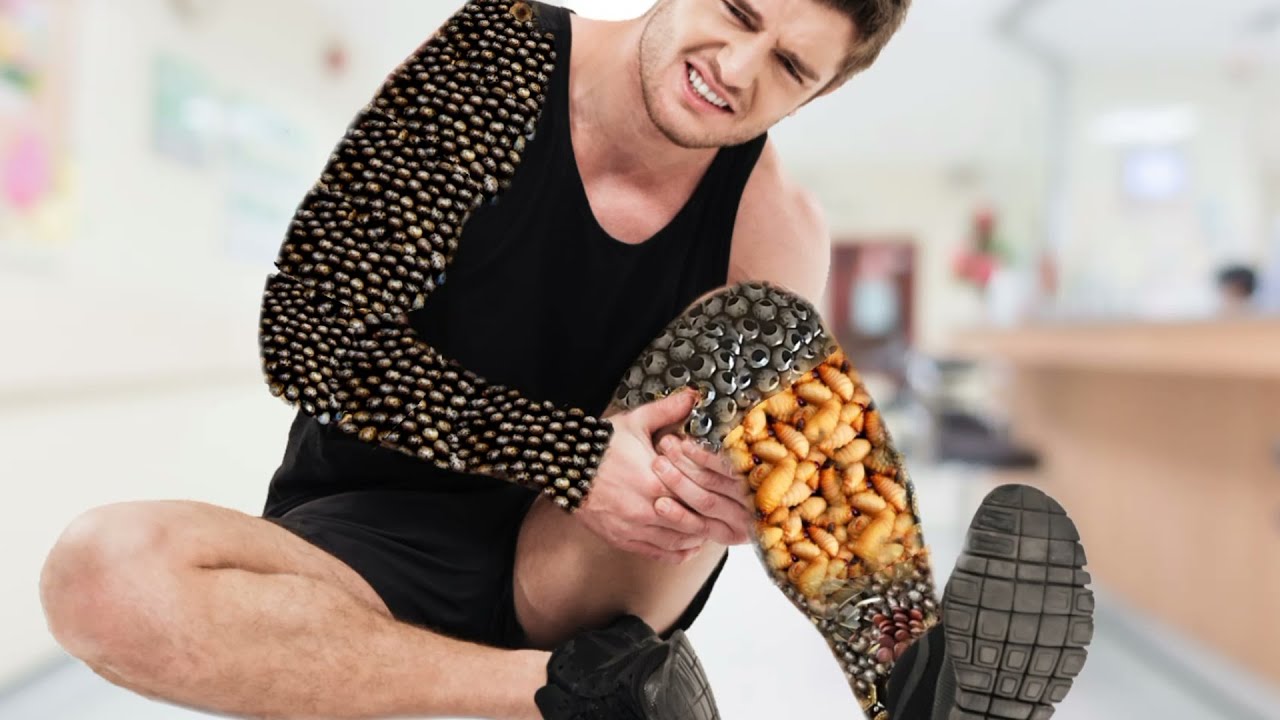 ASMR Leg Treatment | Remove trypophobia & Ticks Infected Leg | ASMR ...