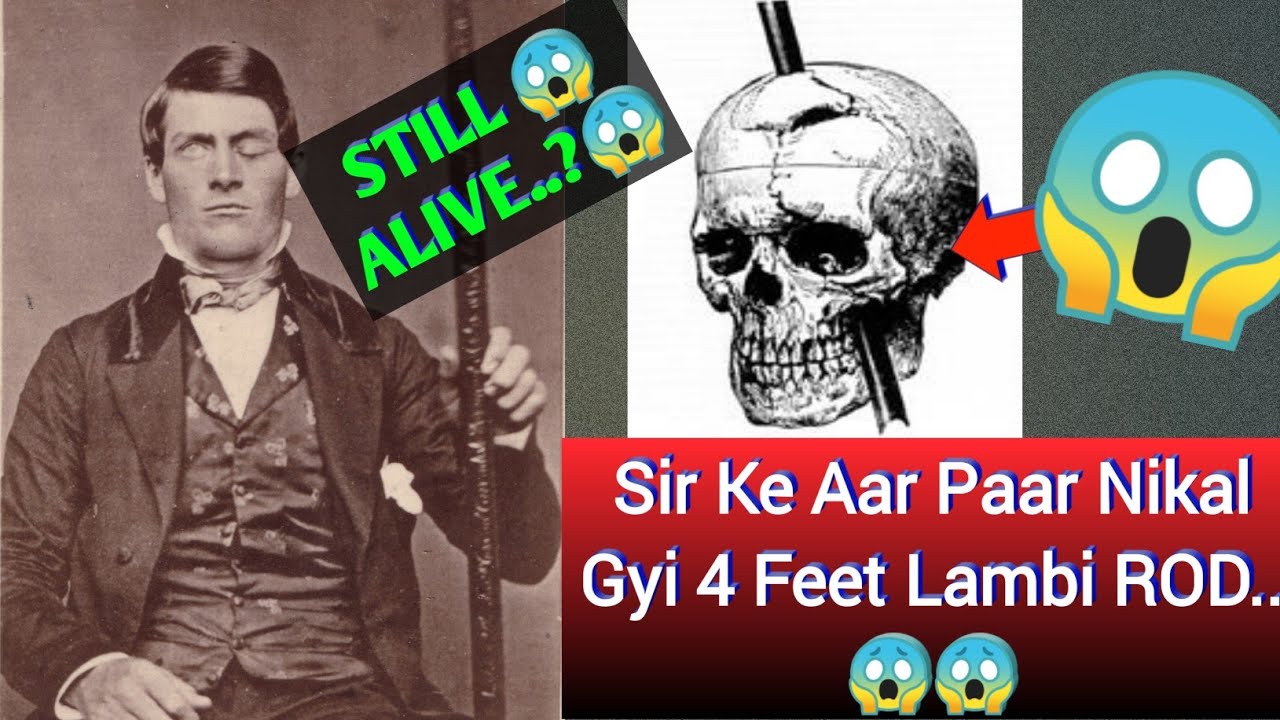 Phineas Gage | Phineas Gage Case Study Psychology | Phineas Gage ...