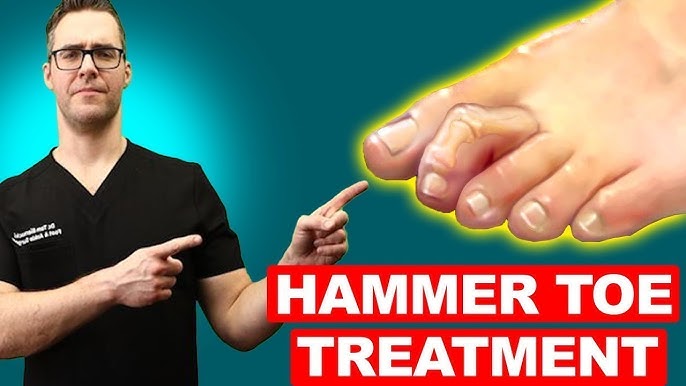 Foot And Ankle Problems By Dr Richard Blake Why Do Toenails Become More Curved As We Age
