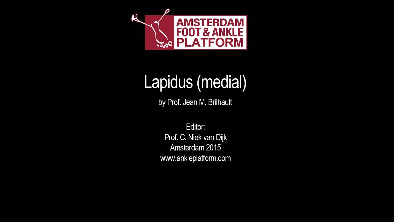 Lapidus - YouTube