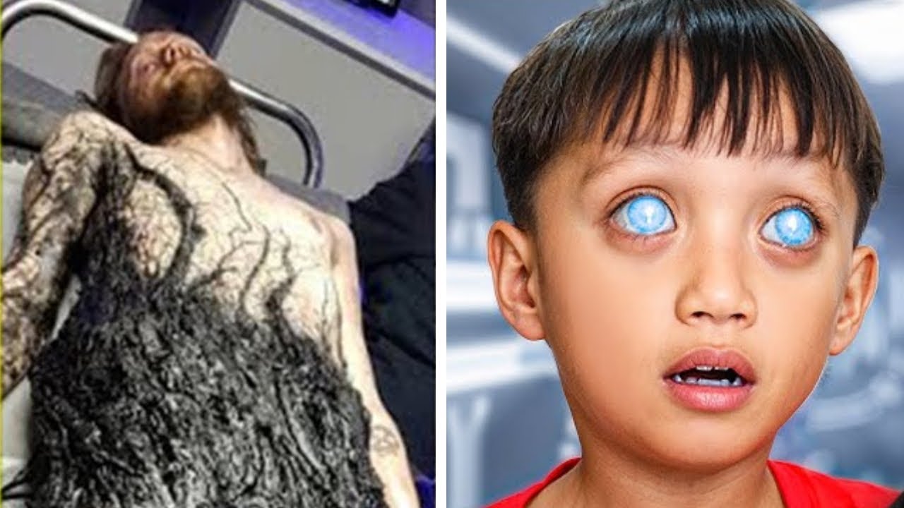 People Who Gained Real Superpowers After An Accident - YouTube