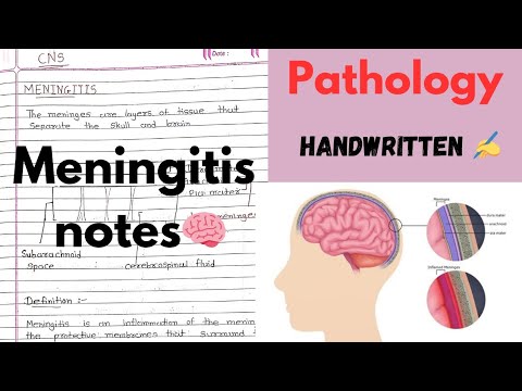 MENINGITIS handwritten notes 📝 || PATHOLOGY || CNS🔥🧠 - YouTube