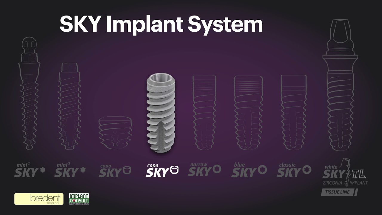 Implant Consult - SKY Implant System - YouTube