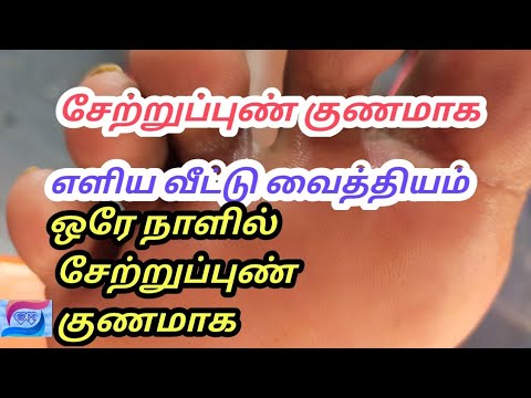 சேற்றுப்புண் குணமாக /சேற்றுப்புண் மருந்து/sethu pun kunmaga, /setrupun ...