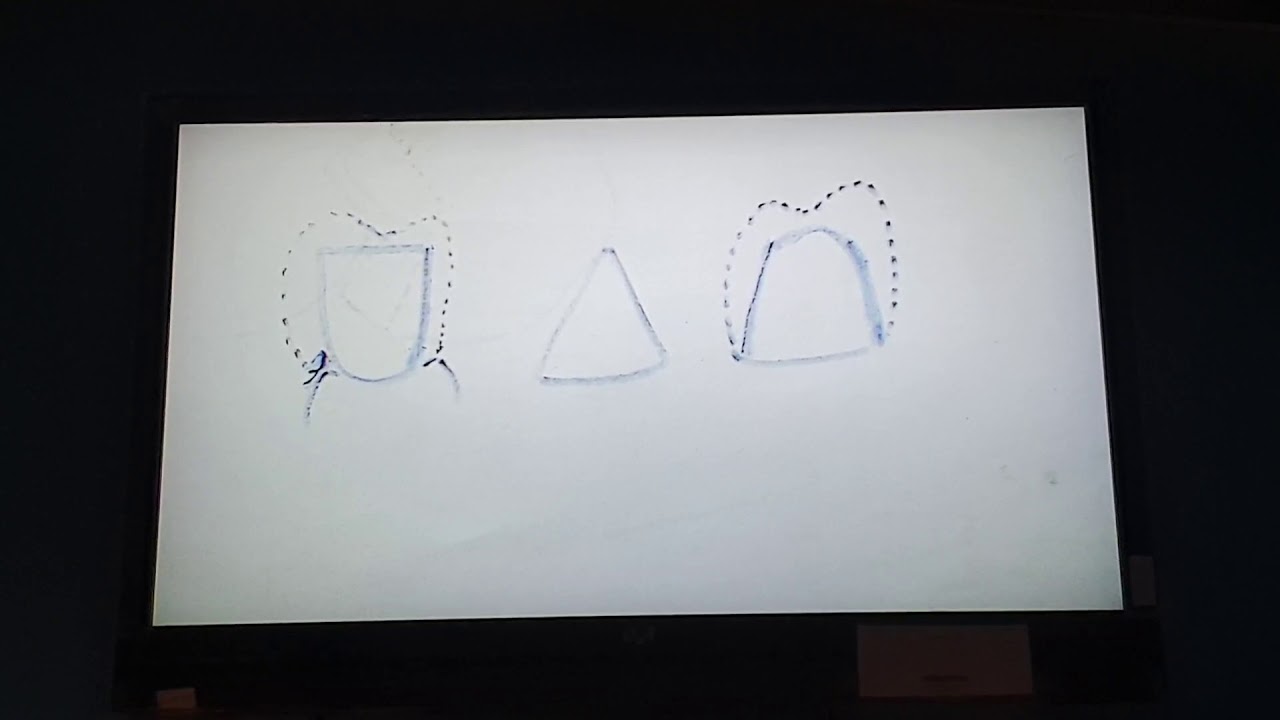 over taper , undercut in tooth preperation - YouTube