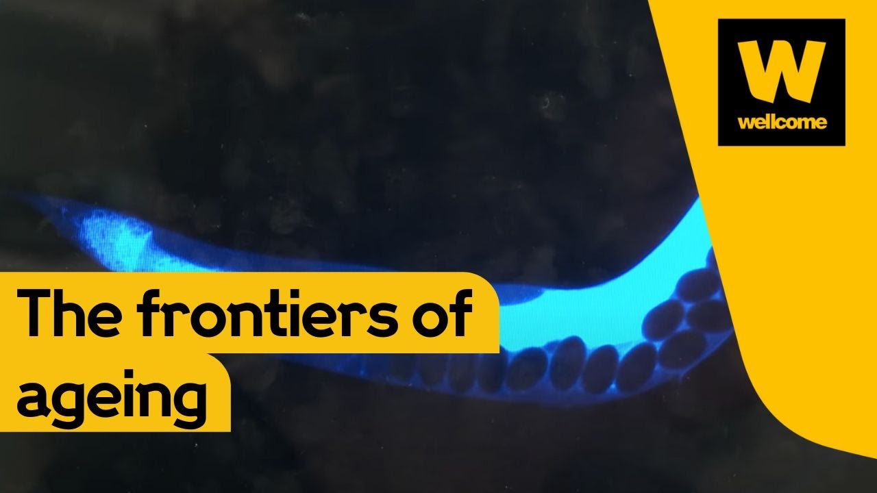 Blue death: The frontiers of ageing research | Wellcome - YouTube