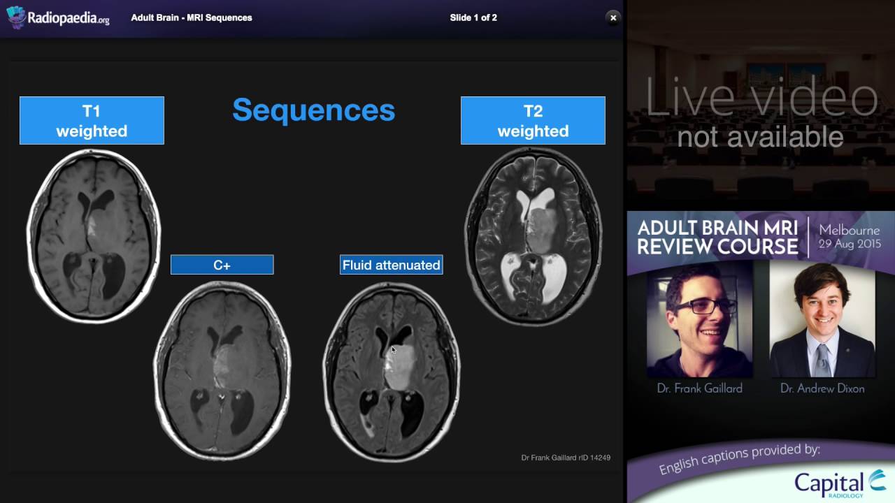 MRI Brain Sequences radiology video tutorial - YouTube