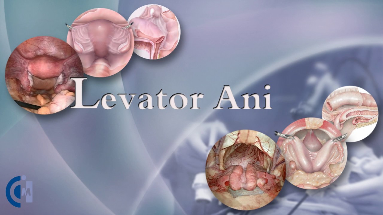 COLPOSACROPEXIA LAPAROSCÓPICA PASO A PASO EN MODELO OVINO - YouTube