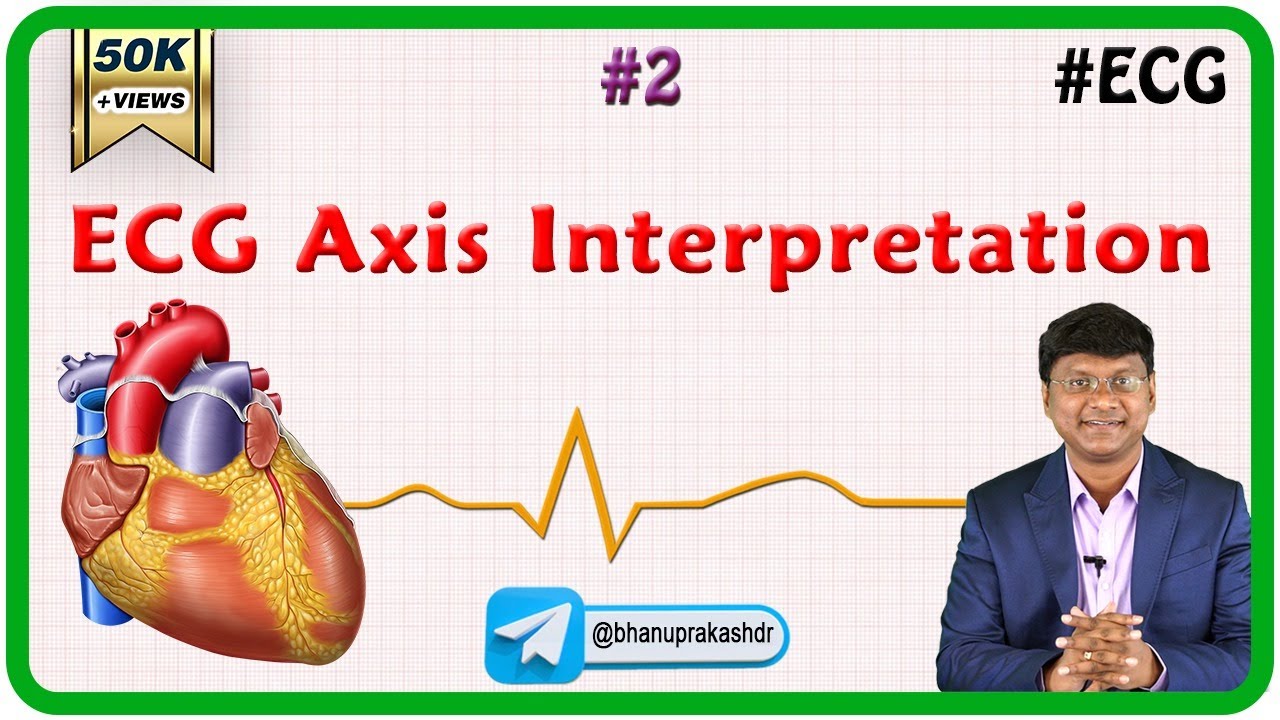 2. ECG Axis Interpretation - ECG assessment and ECG interpretation made ...