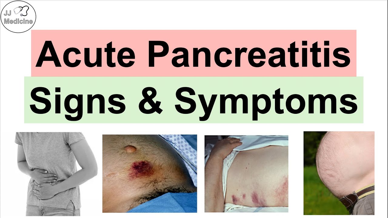 Acute Pancreatitis Signs & Symptoms (& Why They Occur) - YouTube