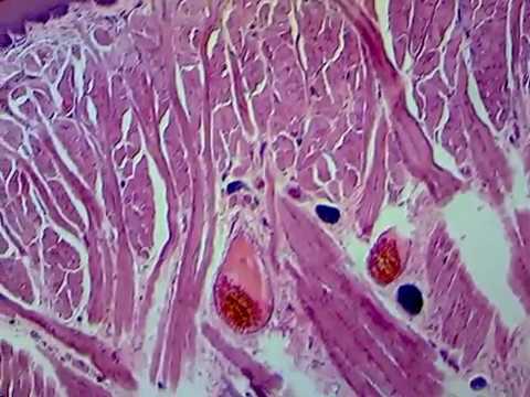 tongue lateral section with taste buds Under the microscope - YouTube