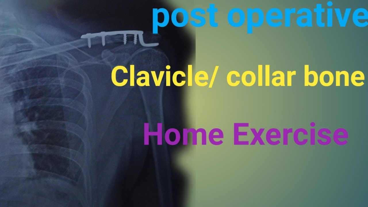 post operative clavicle bone exercise clavicle surgery rehab exercise ...