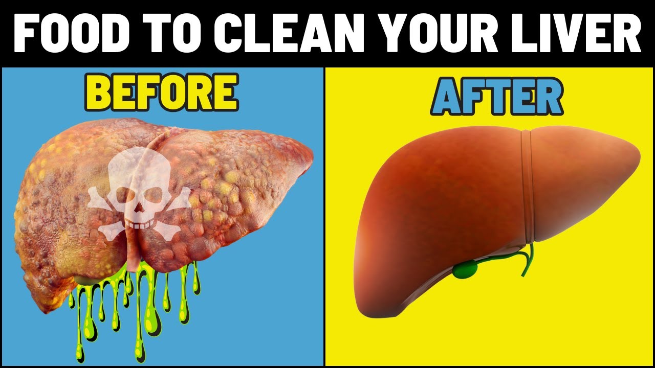 10 SURPRISING Foods To Clean Out Your liver and Reverse Damage - YouTube