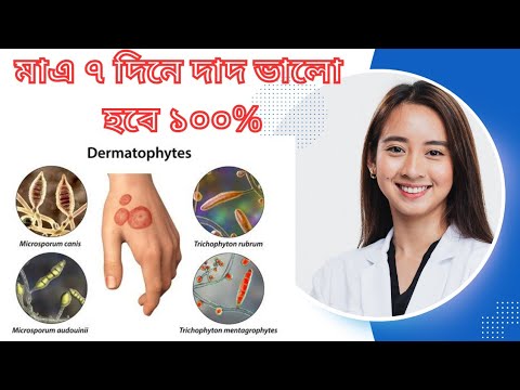 Elvina 250 | Terbinafine 250 | Telfin Tablet full details - YouTube