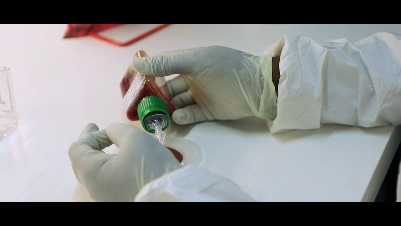 Mini-Lab : le laboratoire adapté aux terrains d'intervention de MSF ...